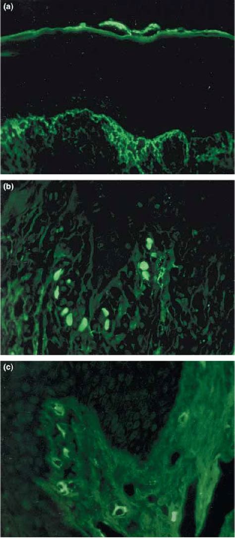 Immunofluorescence Staining Patterns A Shaggy Deposition Of Download Scientific Diagram