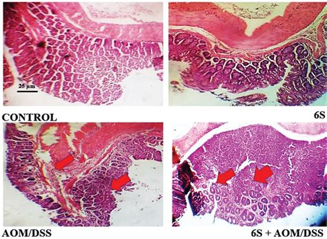 Photomicrographs Of The Colon Of Control And Experimental Treated Mice Download Scientific
