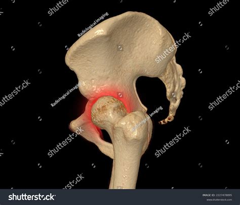 Ct Scan Pelvic Bone Hip Joint Stock Illustration 2227478895 Shutterstock