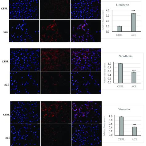 immunofluorescence analysis of e cadherin n cadherin and vimentin a