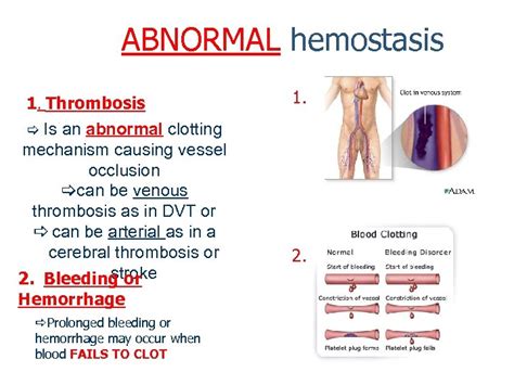 Hemostasis Coagulation Modifying Agents Pathopharmacology Wanda Lovitz