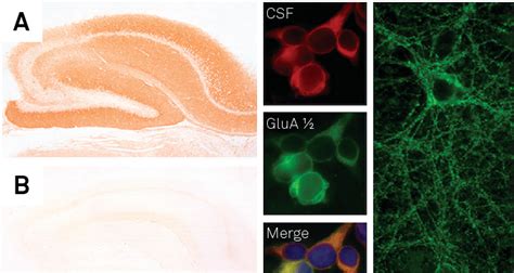 Techniques For The Detection Of Anti Neuronal Antibodies Indirect