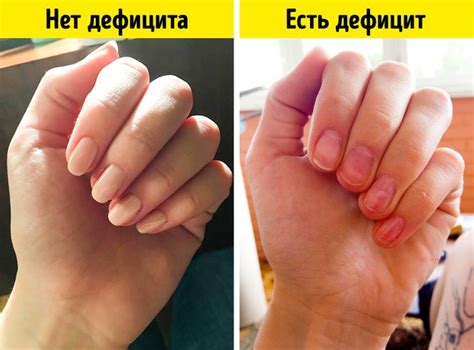 10 ранних признаков нехватки витамина С в вашем организме Adme