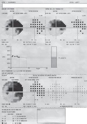 Manual Visual Field Test