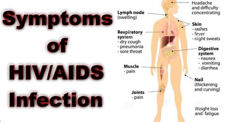 Hivaids Symptoms For Men And Women Jamiinzuri