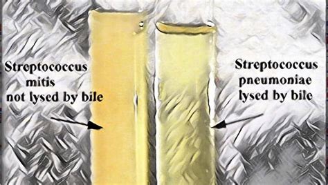 Bile Solubility Test Principle Procedure Results Quality Control