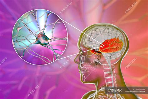 Human Brain With Highlighted Temporal Lobe And Close Up View Of Neurons Located In Temporal Lobe