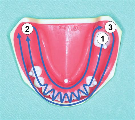 Routine Process For Full Arch Intraoral Scanning Of A Mandibular