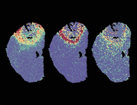 Srikanth Subramanian On Linkedin Integrating Spatial And Single Cell