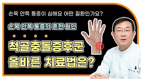 손목 안쪽 통증의 흔한 원인 척골충돌증후군 Youtube
