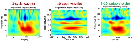 BME EEG Analysis Wavelet Transform Aursus