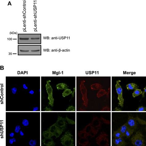 Knock Down Effect Of Usp11 On Cancer Cells A Knockdown Effect On Download Scientific Diagram