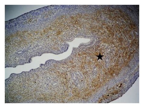 Vitronectin Immunoreactivity In The Extracellular Matrix Starred In Download Scientific