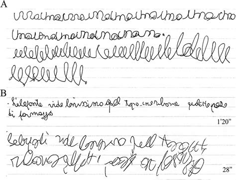 Handwriting Performance A Patient 12 Example Of Handwriting During
