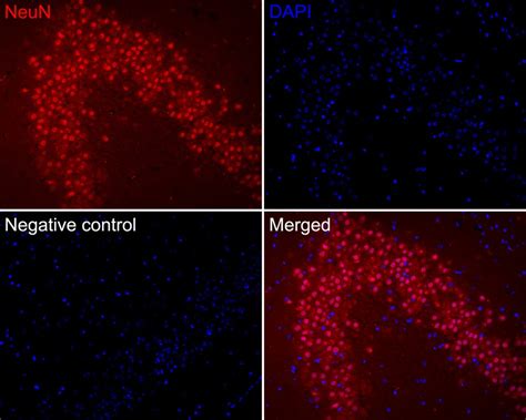Ifluor™ 594 Conjugated Neun Recombinant Rabbit Monoclonal Antibody [sr Huabio