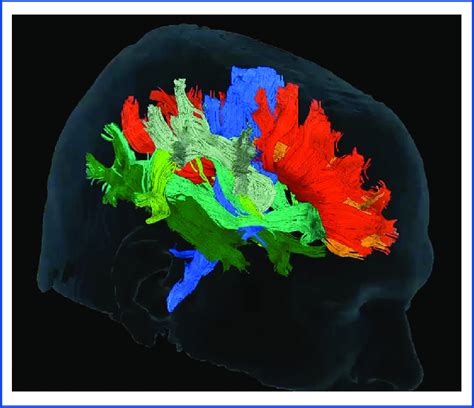 example rendering of the swmc based on an automated seeding algorithm download scientific