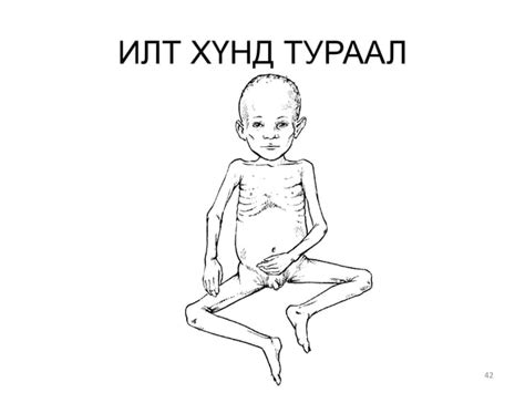Эрэмбэлэн ангилалт яаралтай тусламж хичээл Ppt