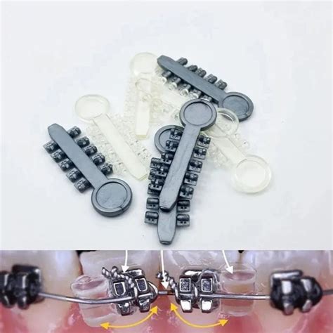 Dental Orthodontic Rotation Wedges For Archwire Brackets Braces