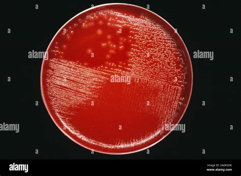 Gas Gangrene Bacteria Clostridium Perfringens Colonies White Being