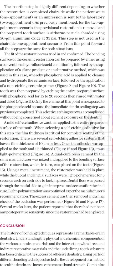 Adhesive Dentistry The Development Of Immediate Dentin Sealing