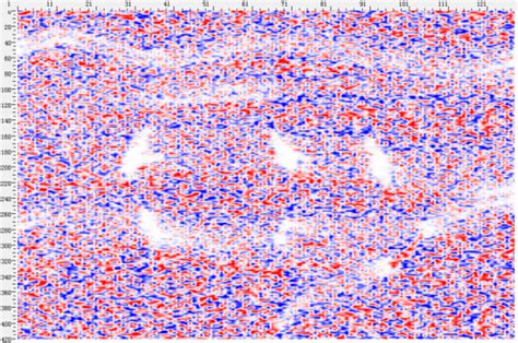 Noise Of Nlm Algorithm Based On Structure Tensor δ 2 5 × 10⁻¹² Download Scientific Diagram