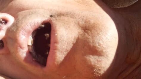 Flies Into The Mouth Thisvid Com