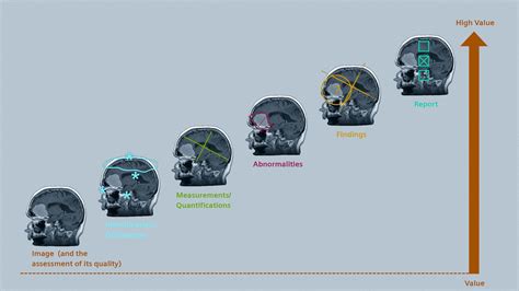 Artificial Intelligence For Mri Siemens Healthineers