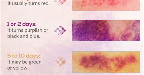 National Cancer Society Of Malaysia Penang Branch What The Color Of