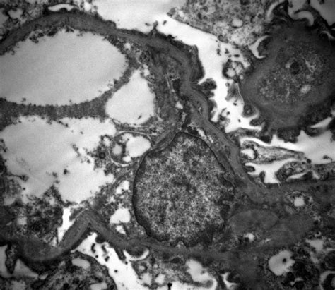 Electron Micrograph Of A Glomerular Capillary Loop Uranyl Acetate And Download Scientific