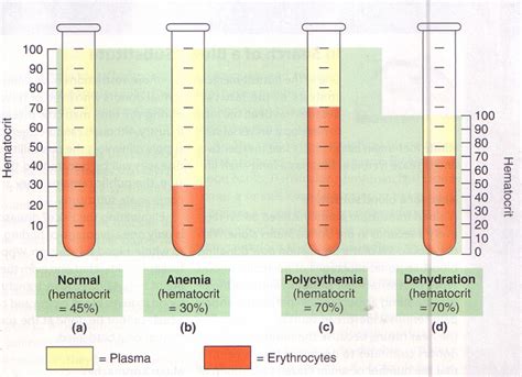 Hematocrit 33 Hematocrit Levels And Mortality Risk In Hemodialysis Patients A Comprehensive