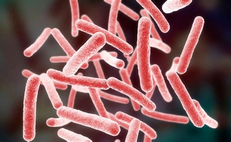 Mycobacterium Chimaera Infections Causes And Treatment