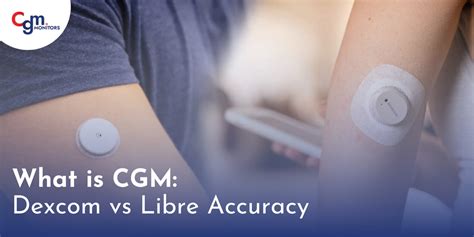 What Is Cgm Dexcom Vs Libre Accuracy Cgm Monitors