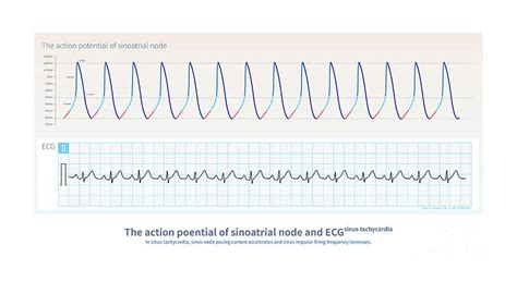 Sa Node Action Potential