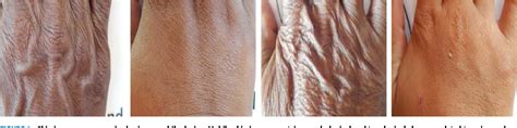 Figure 1 From Skin Microstructure Segmentation And Aging Classification