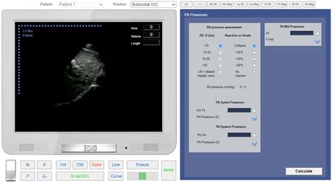 Pa Diastolic Pressure