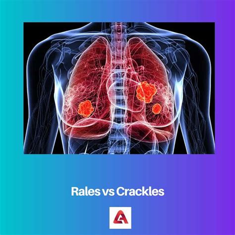 React Vs Respond Difference And Comparison