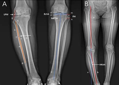 Schematic Diagram Of The Imaging Measurement Methods A Mpta Was Download Scientific Diagram