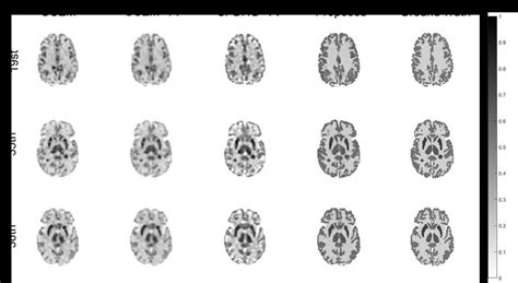 Reconstruction Result Of Osem Spdhgtv And Proposed Method The 19st