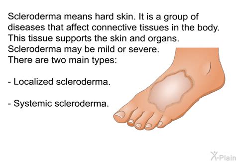 Scleroderma Scleroderma