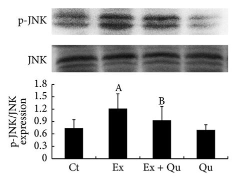 Protein Expression Of Nf κb P65 And P50 Subunits And Jnk And Activity