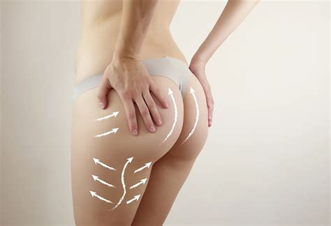 Buttock Augmentation In Tunisia Sculpt Your Curves