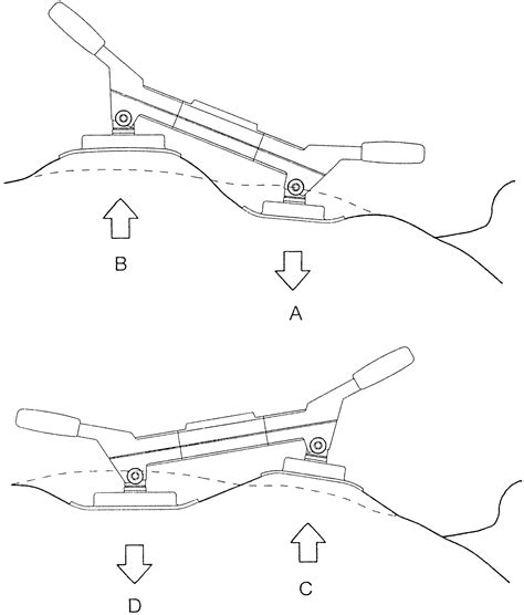 Phased Chest And Abdominal Compression Decompression Circulation