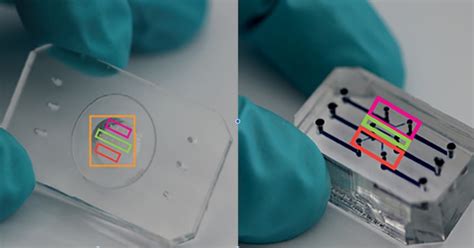 AI Powered Biosensor Facilitates Detection Of Neurodegenerative Diseases