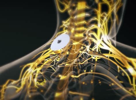 Neuromodulation Non Invasive Centre De Bionomie