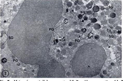 Figure 1 From Ultrastructural Localization Of Myeloperoxidase In Human Neutrophil And Rabbit