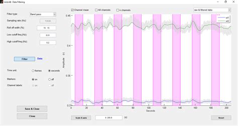 Fnirs Analysis Nirs Analysis Techniques Homer2 Nirs Toolbox Nirs Spm Nirslab Fnirs