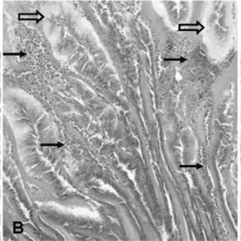 Histopathological Lesions In The Mucosa Of Chicken Proventriculus At 48