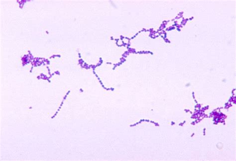 Strep Throat Microscopic View