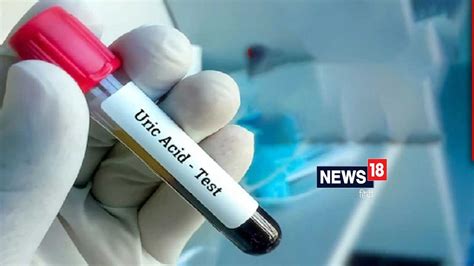 Foods You Must Avoid If Your Uric Acid Levels Are High Lifestyle News News