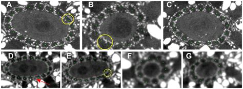 Automatic Seed Point Initialization Results Of Automatic Seed Point Download Scientific